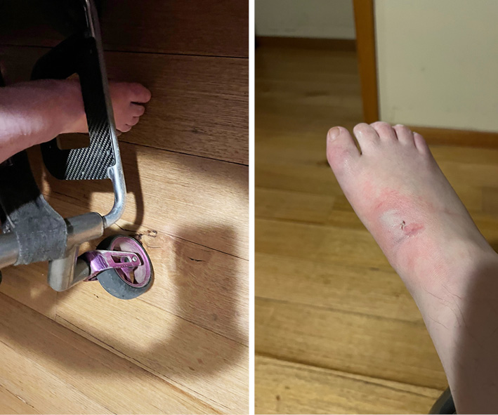 My ten tips for buying a wheelchair - AQA